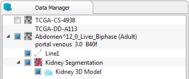 May I introduce you to MITK?