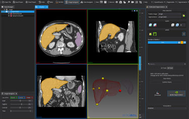 The Medical Imaging Interaction Toolkit (MITK) - mitk.org