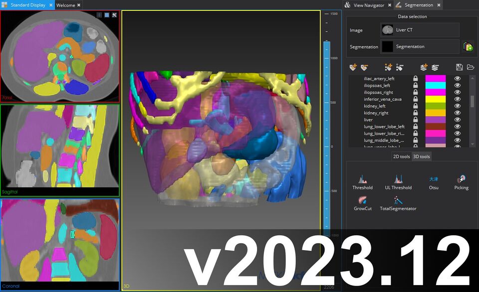 The Medical Imaging Interaction Toolkit (MITK) - mitk.org