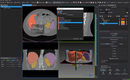 The Medical Imaging Interaction Toolkit (MITK) - mitk.org