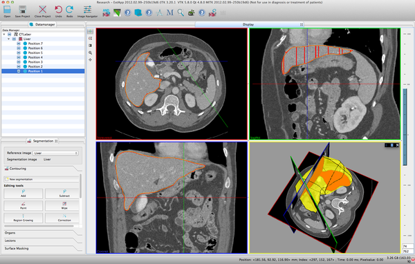 MITK ReleaseNotes 2012.06 - mitk.org