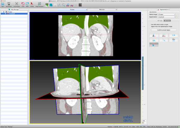 MITK ReleaseNotes 2014.03 - mitk.org