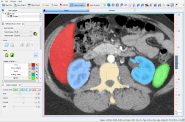 The Medical Imaging Interaction Toolkit (MITK) - mitk.org