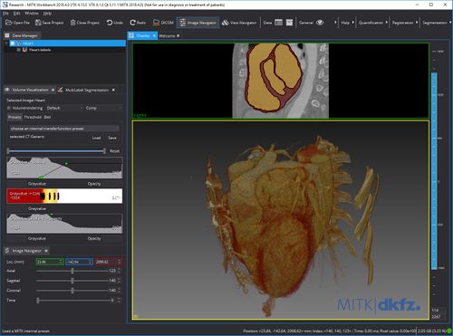 The Medical Imaging Interaction Toolkit (MITK) - mitk.org