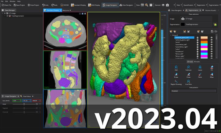 The Medical Imaging Interaction Toolkit (MITK) - mitk.org
